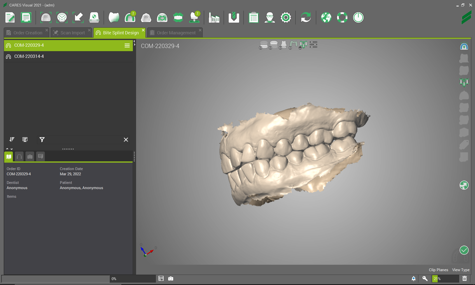 CAD - How to correct the unwanted bite space created by the virtual ...