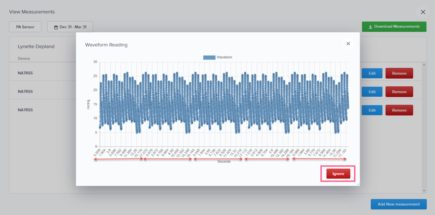 How to View CardioMEMS Waveform Data - RhythmScience Knowledge Base