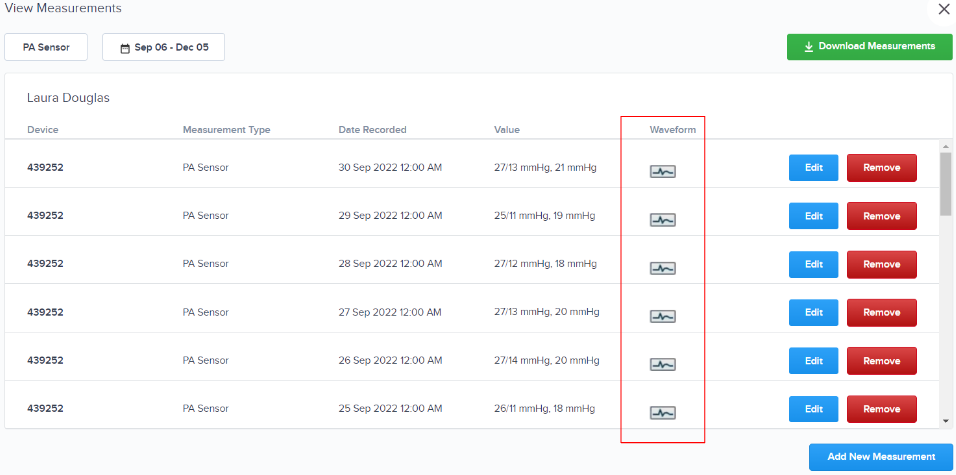 How to View CardioMEMS Waveform Data - RhythmScience Knowledge Base
