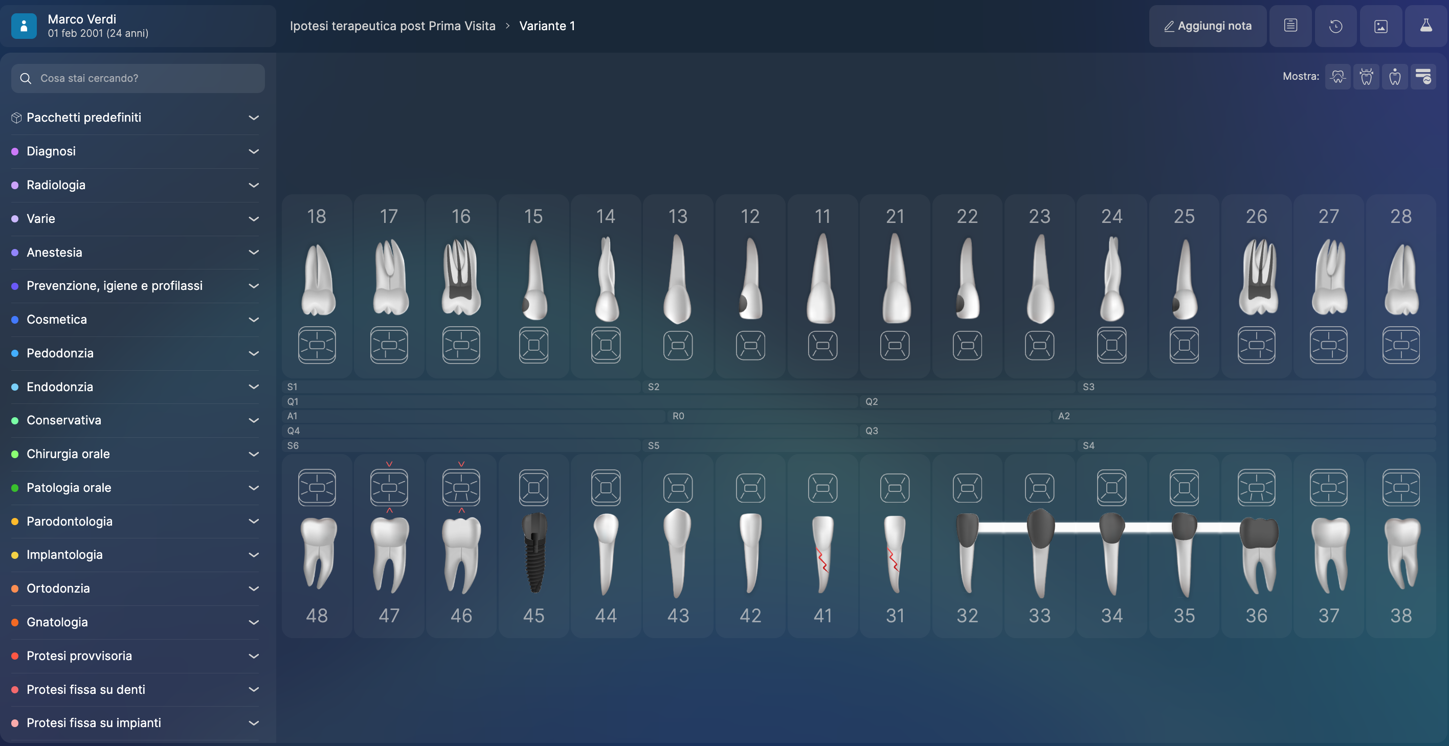 Ipotesi terapeutica - Alfred al tuo servizio